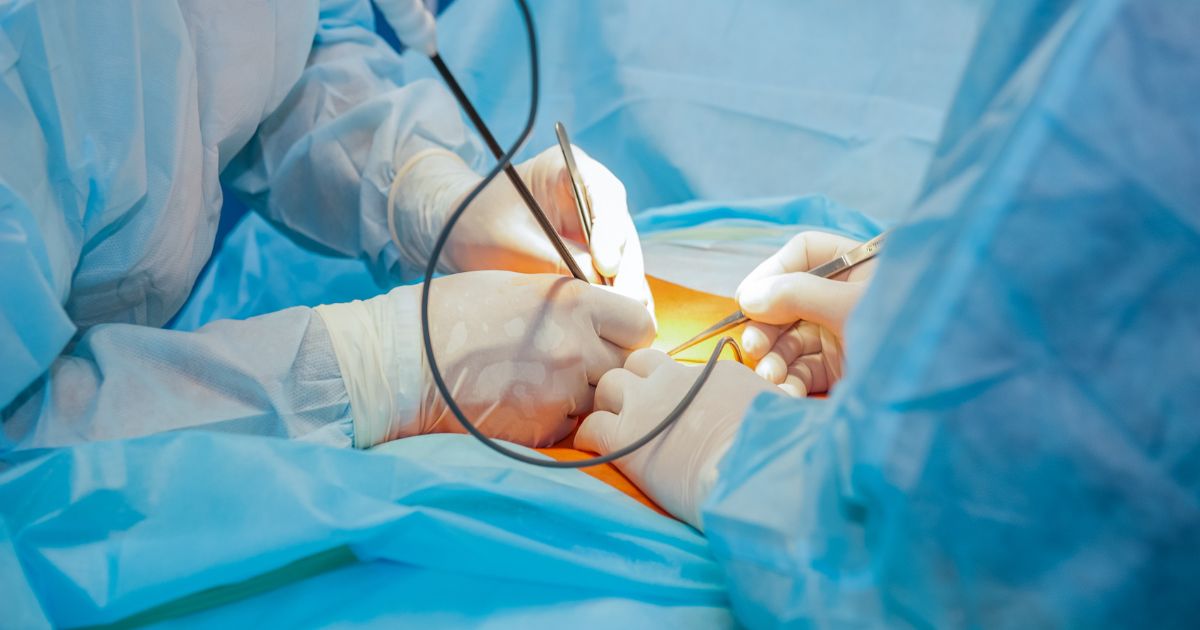 Can HIPEC Improve Life Expectancy? | 877-743-4652